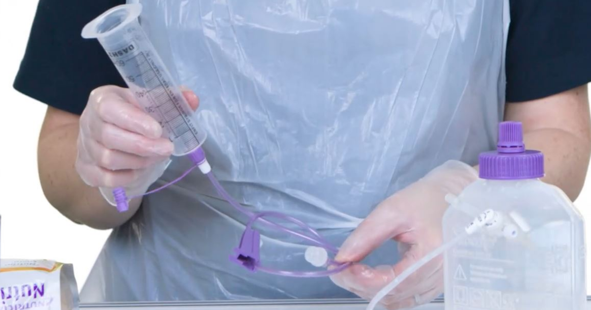 Jejunostomy tube care and feeding