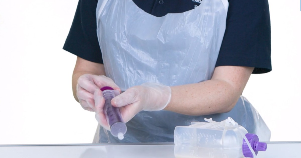 Gastrostomy feeding and care